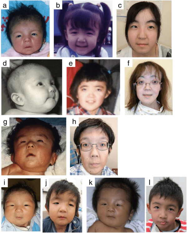 Le SEDmc - SED musculocontractural - SED in FRANCE